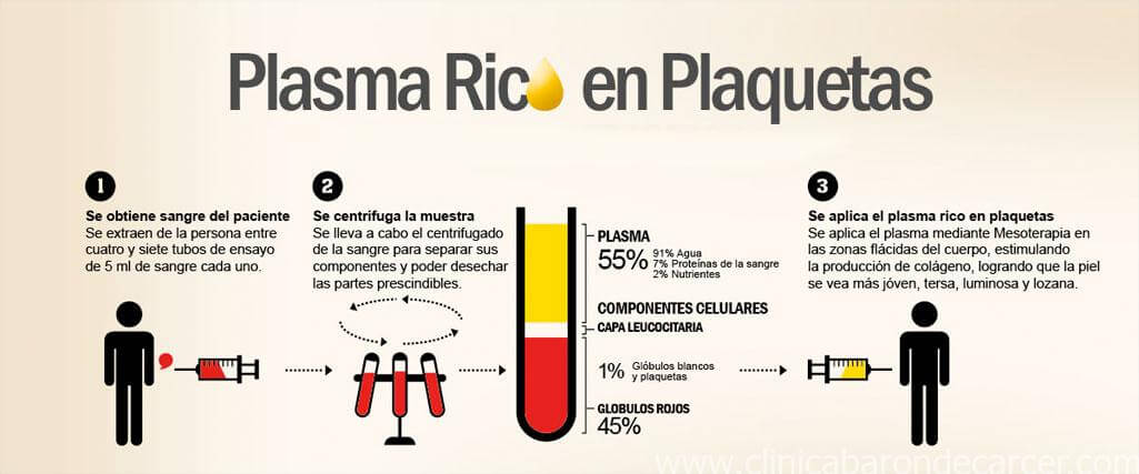 ¿Conoces el Plasma Rico en Plaquetas?
